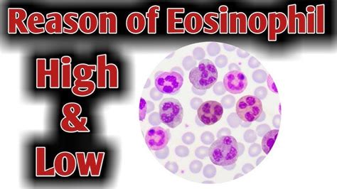 What Are Eosinophils Definition Low High Reference