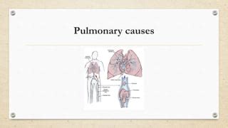 ECG T Wave Inversion Dr Malala Rajapaksha Cardiology Unit General Hospital Matara Sri Lanka