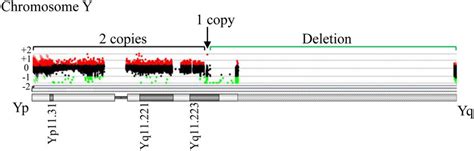 Array Comparative Genomic Hybridization Analysis Of The Patient