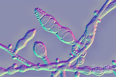 Microsporum Audouinii Fungus 2 By Science Photo Library