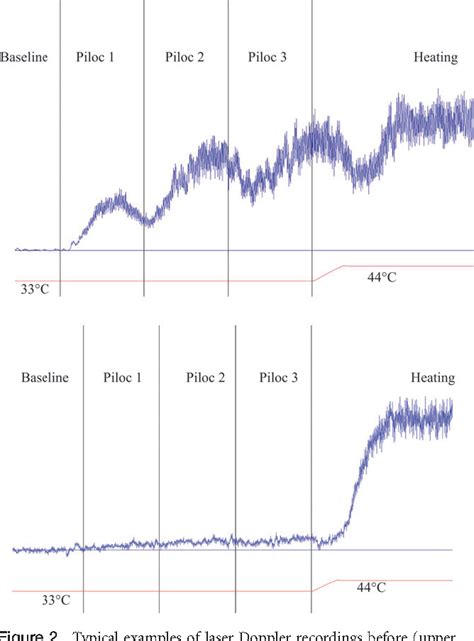 Angiogenesis Inhibition Semantic Scholar