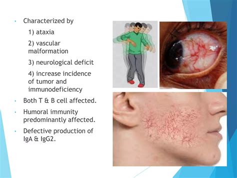 Primary Immunodeficiency Disorders Pptx