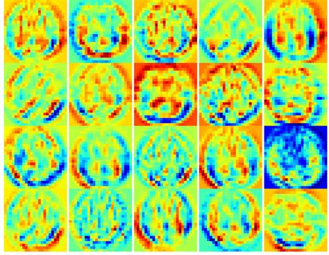 The Features Of First Convolutional Layer In Lenet