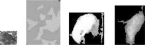 Brain Tumor Mr Images Malignant Type Download Scientific Diagram