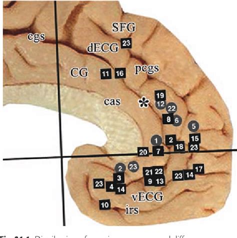 Figure 21 1 From The Role Of The Anterior Cingulate Cortex In Posttraumatic Stress And Panic