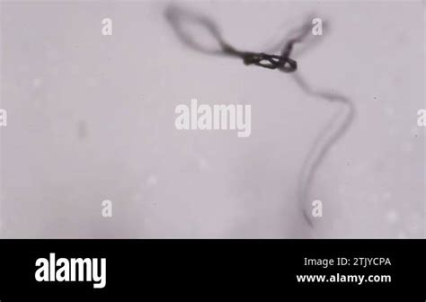 Prokaryote And Microscope Stock Videos And Footage Hd And 4k Video