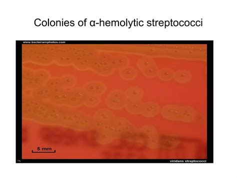 Staphylococcus Streptococcus Bacteriological Diagnosisii Ppt Staphylococcus Streptococcus Bacteriological Diagnosisii Ppt
