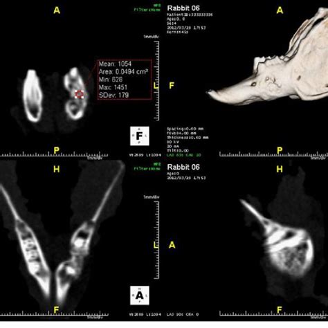 Multi Detector Row Computed Tomography Analysis Showing The Process For Download Scientific