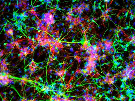 Neural Stem Cells Differentiating Into Neurons And Glial Cells