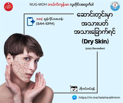 Dry Skin “ ဆောင်းတွင်းအသားပတ်ခြင်း” December 2022 တယ်လီကျန်းမာ