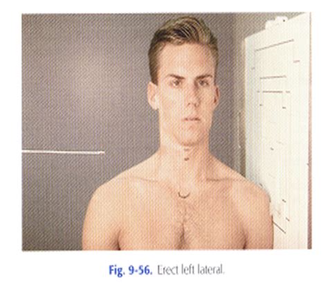 C Spine Technique Flashcards Quizlet