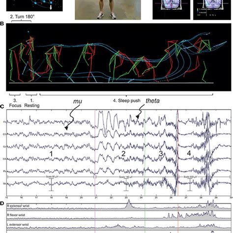 A Recording Configuration Simultaneous Eeg Lfp And Whole Cell Download Scientific Diagram