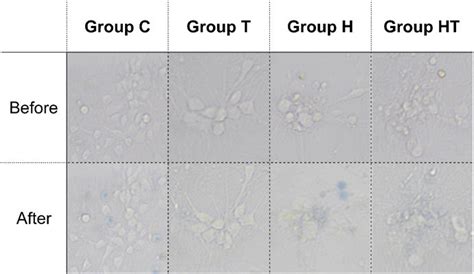 Transmitted Light Photomicrographs Of Cultured Cortical Neurons Before