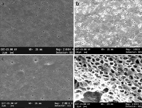 Scanning Electron Micrographs Of Asymmetric Membrane Depicting A Outer Download Scientific