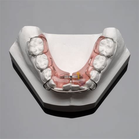 Headgear Orthodontic Appliance At Kathleen Gorham Blog