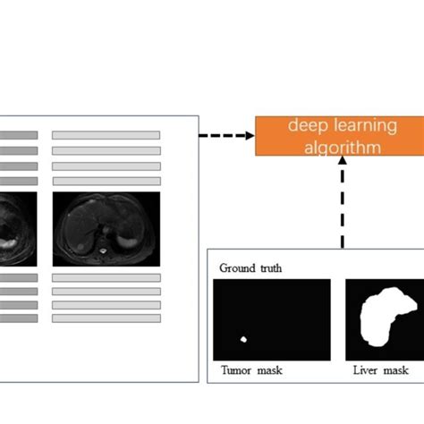 Automated Segmentation Process To Make Masks The Mr Arterial Phase Download Scientific