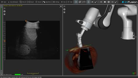 Nicola Rieke On Linkedin Our Inception Member Imfusion Gmbh Goes