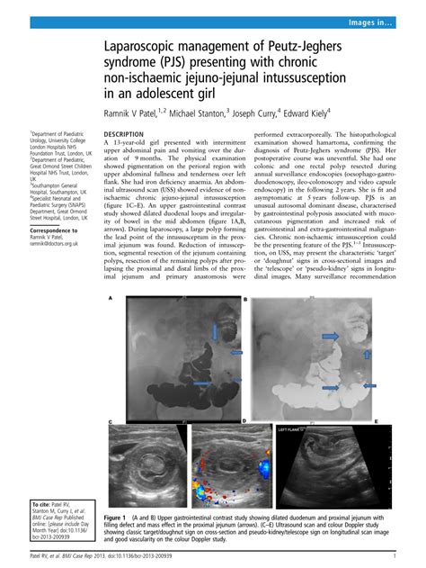 Pdf Laparoscopic Management Of Peutz Jeghers Syndrome Pjs The Best