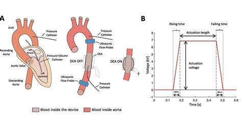 Artorg Center For Biomedical Engineering Research On Linkedin How An Aorta Actuator Influences