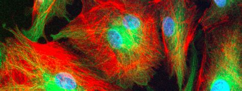 Protein Colocalization You Know They Overlap But Can You Prove It Bitesize Bio