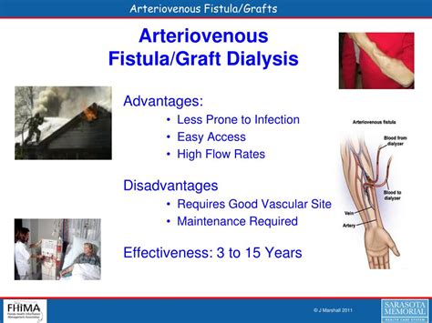 Dialysis Catheter Vs Graft At Guadalupe Harshaw Blog