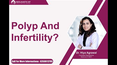Polyp And Infertility Can Polyps Cause Infertility YouTube