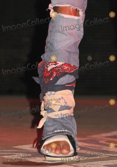 Photos And Pictures 15 July 2011 Morristown Ohio A Broken Foot