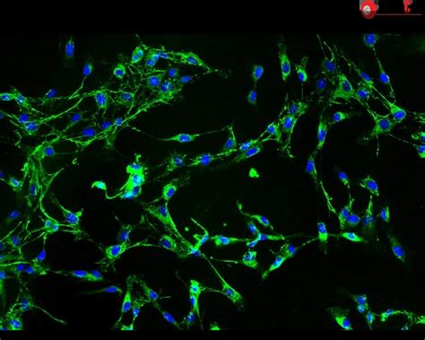 Human Aortic Adventitial Fibroblasts Haaf