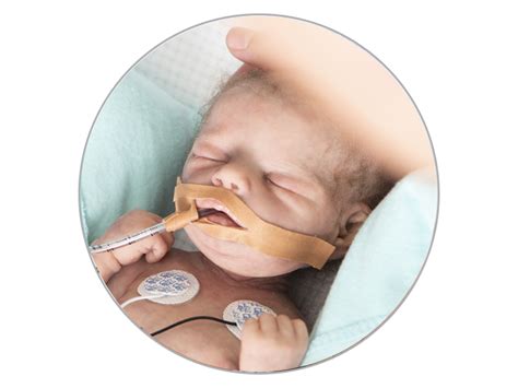 Neonates Fandp 950 System Fisher And Paykel Healthcare