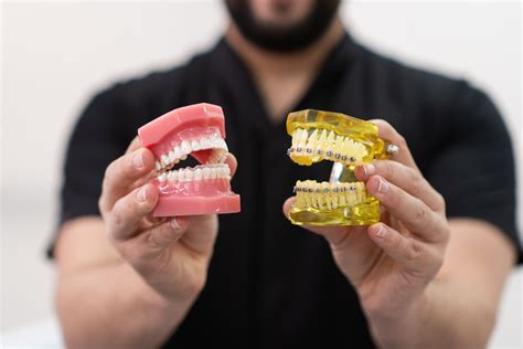 Clear Aligners Vs Braces Key Differences In Orthodontic Treatments Victoria Hutta Orthodontics