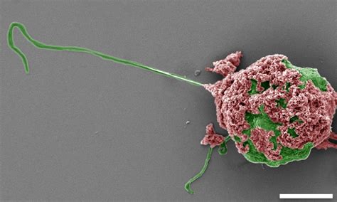 Scientists Create Futuristic Pill That Releases Microscopic Robots Into Body To Treat