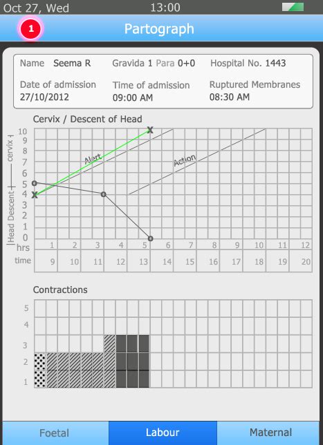 E Partogram On Behance