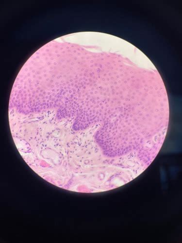 Histo Slides Set 2 Epithelial Cells Flashcards Quizlet