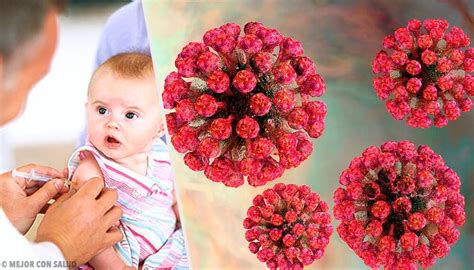 Rubéola Mejor Con Salud