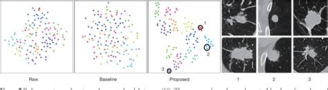 Figure From Narrative Review Of Generative Adversarial Networks In Medical And Molecular