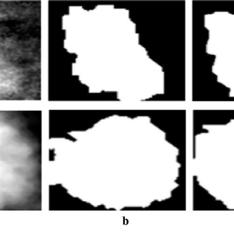 Segmentation Results Top To Bottom A Real Angiograms B Ground Download Scientific