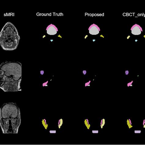 Three Orthogonal Views Of One Case Smri Synthetic Mri Download