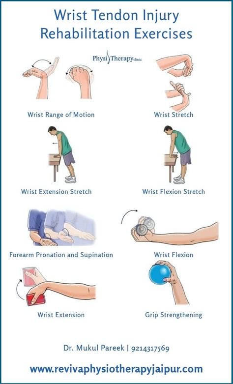 Extensor Tendonitis Exercises Pdf At Samantha Tennant Blog