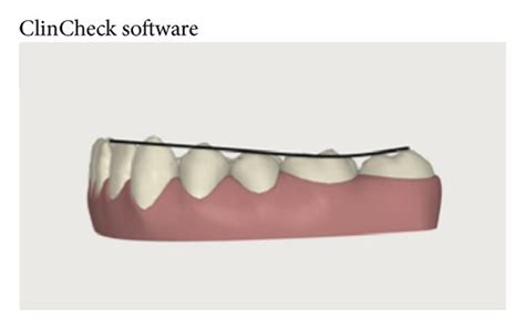 A Curve Of Wilson B Curve Of Spee In The Right Side And C Curve Download Scientific