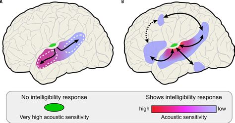 Primary Auditory Cortex