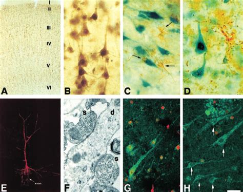 Histology And Viability Staining Of Motor Cortex Slices After Long Term Download Scientific