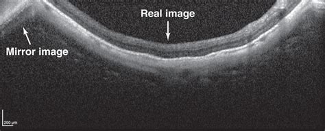 Oct Artifacts And Errors Clinical Tree