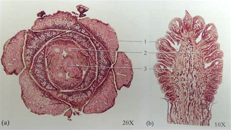 Ovulate Cones Of Pinus A Transverse B Longitudinal Diagram Quizlet