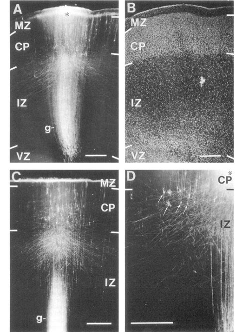 Figure 1 From Development Of Local Circuits In Human Visual Cortex Semantic Scholar