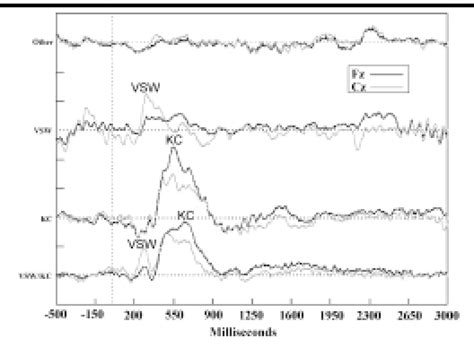 Example Waveforms Illustrating The Different Types Of Phasic Responses