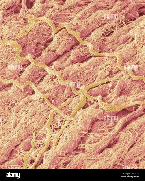 Dense Connective Tissue Coloured Scanning Electron Micrograph Sem Main Component Tissue Collagen