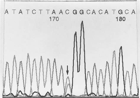 Table 1 From An Mtdna Mutation In The Initiation Codon Of The