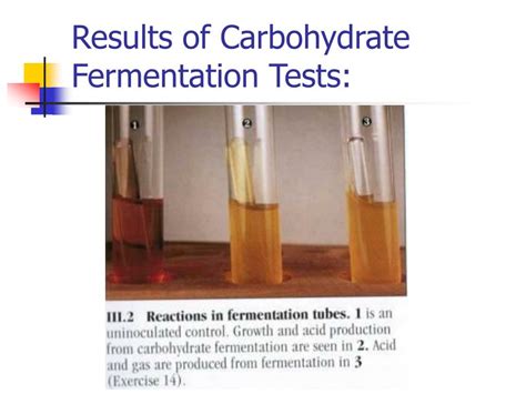 Ppt Biochemical Tests Powerpoint Presentation Free Download Id1710431