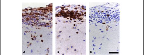 Ten Days After Implantation Of Subdural Grid Electrodes Download Scientific Diagram