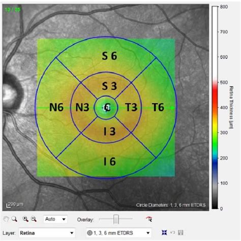 Retinal Layer Segmentation Download Scientific Diagram